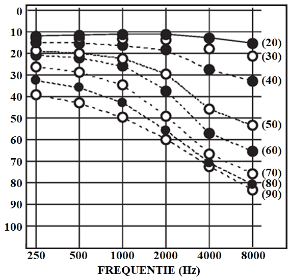 audiometrie
